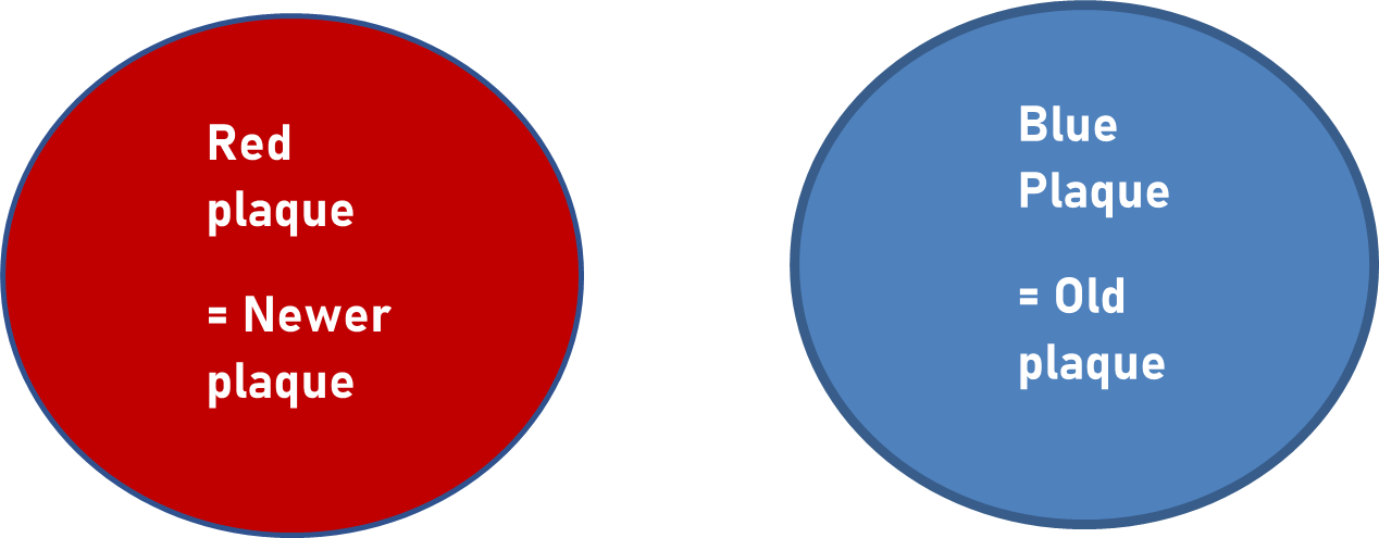Children's Teeth - Lock-down Brushing - New Street Dental Care